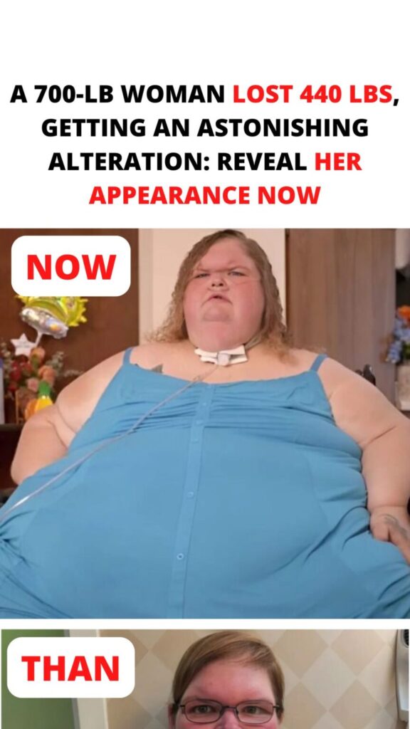 A 700-Lb Woman Lost 440 Lbs, Getting An Astonishing Alteration: Reveal ...